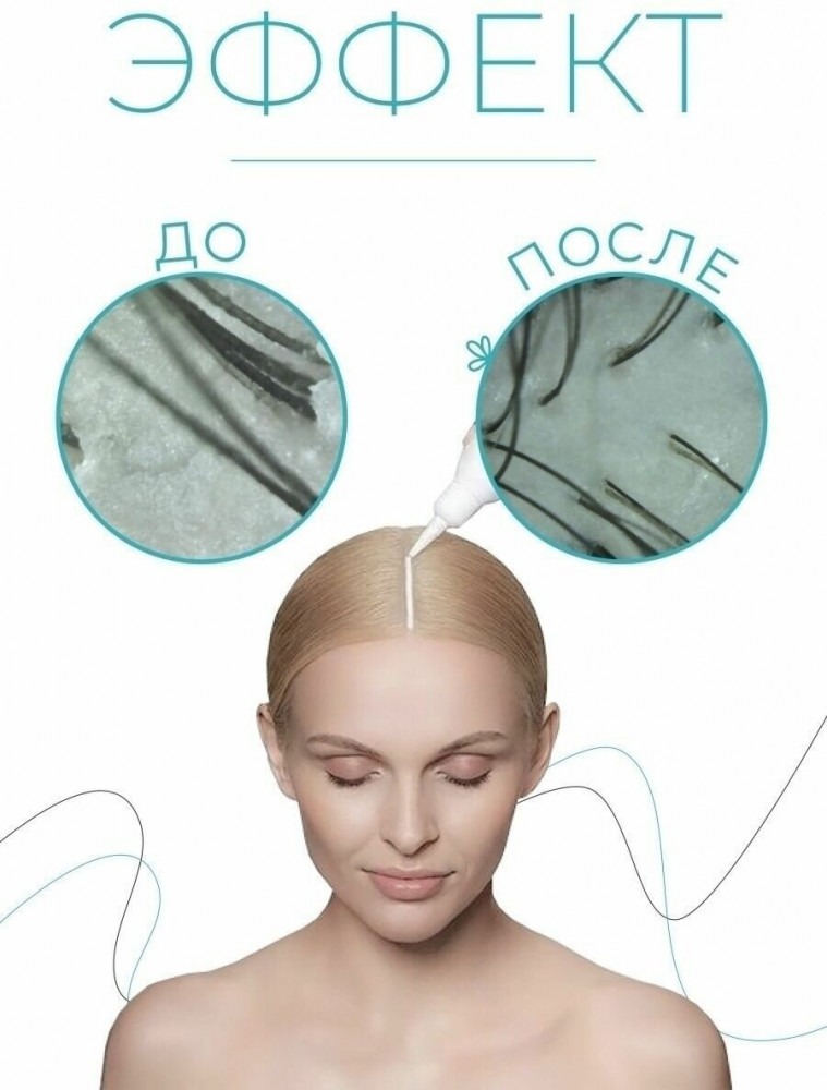 Пилинг для кожи головы «Home Care» — TaShe Professional